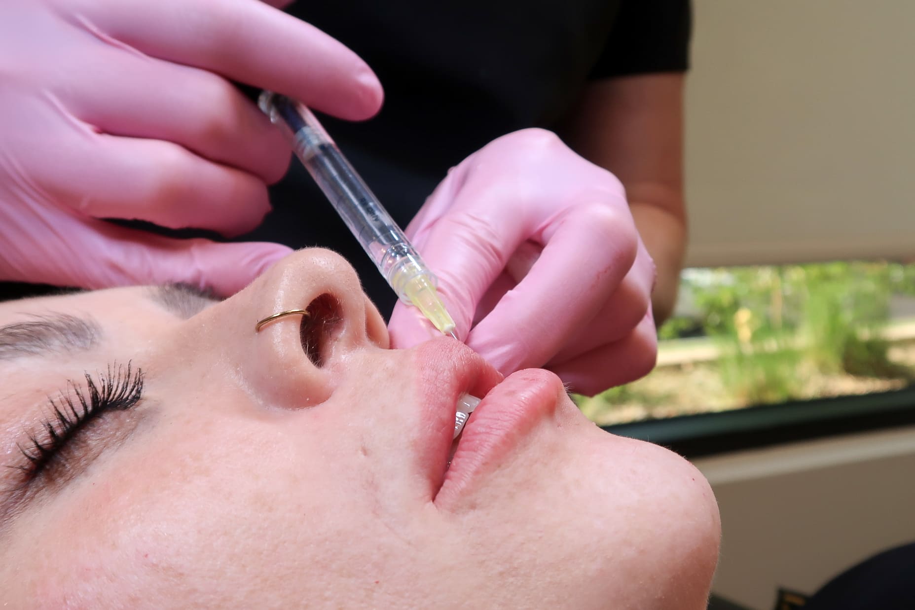 Level 2: Specialty Injectables Training - Power of the Pout - Core Aesthetics Training Institute